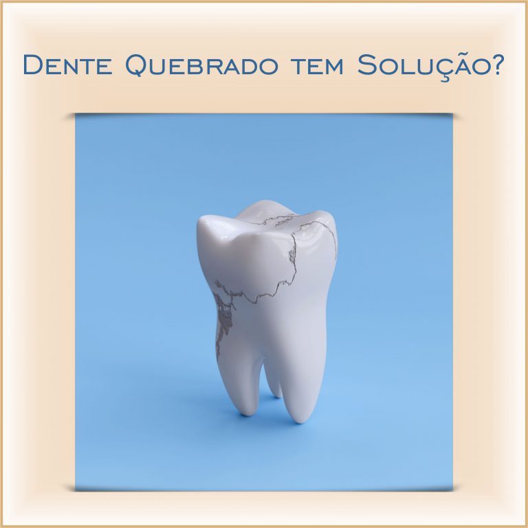 Dente Quebrado tem Solução? – Inovarp – Dra. Claudia Bustamante